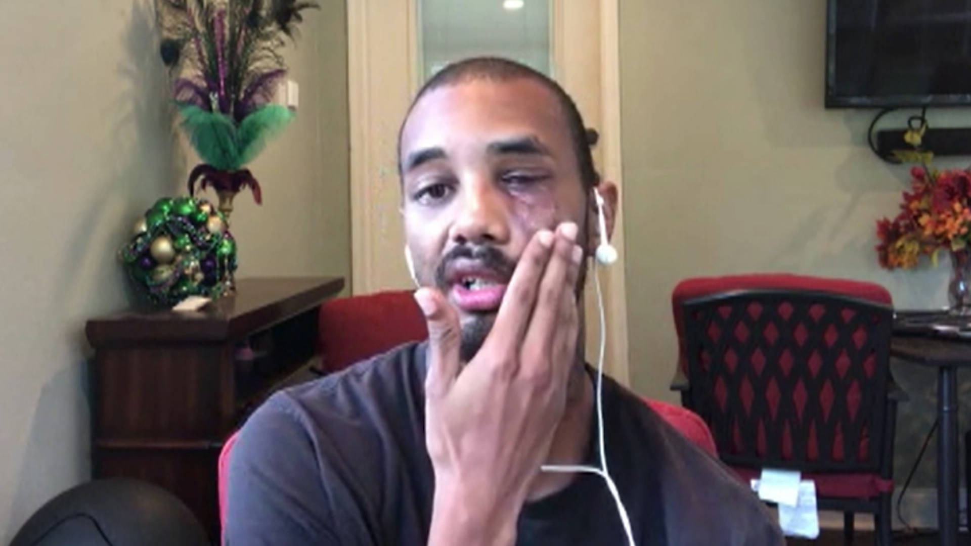 Meet Brandon Saenz: Dallas Protester Who Lost Eye After Police Shot Him ...
